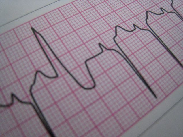 12-Lead ECG Course - Medical Training Solutions